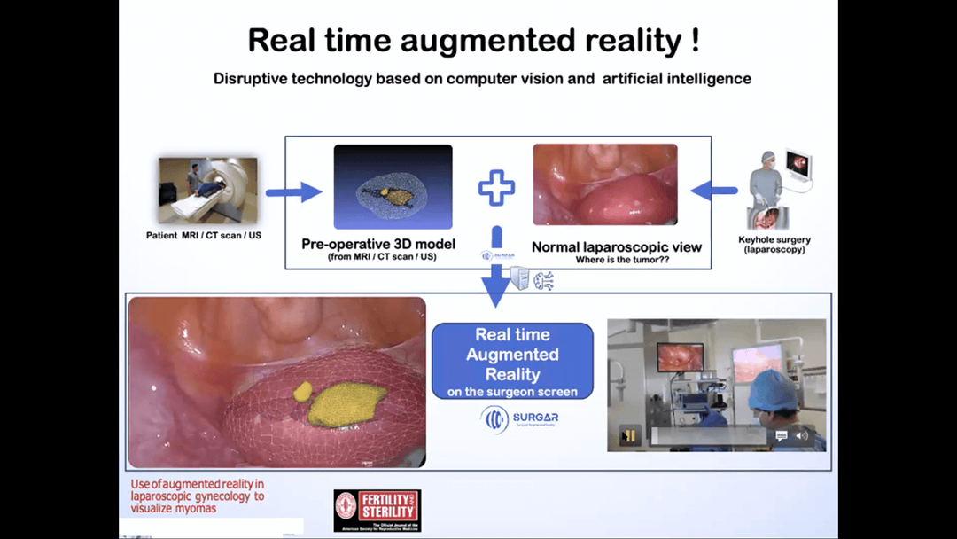 Augmented Reality in Gynecological Surgery – International IVF Initiative