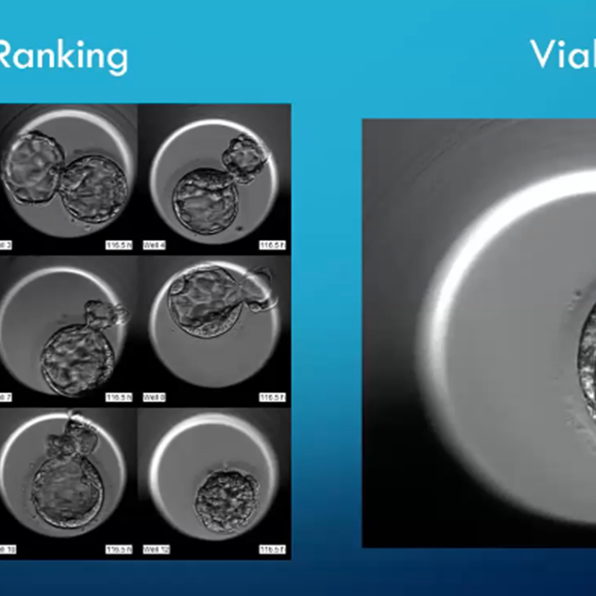 AI in Assisted Reproduction – International IVF Initiative