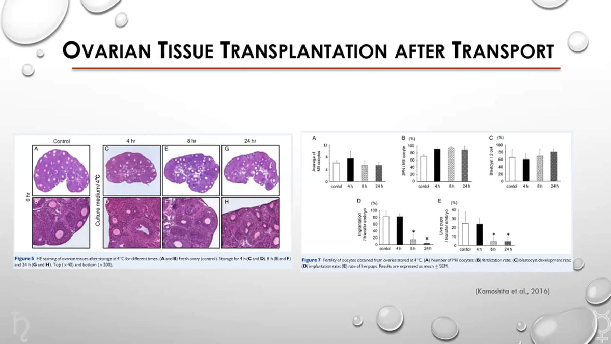 The importance of ovarian tissue transportation for fertility outcomes ...